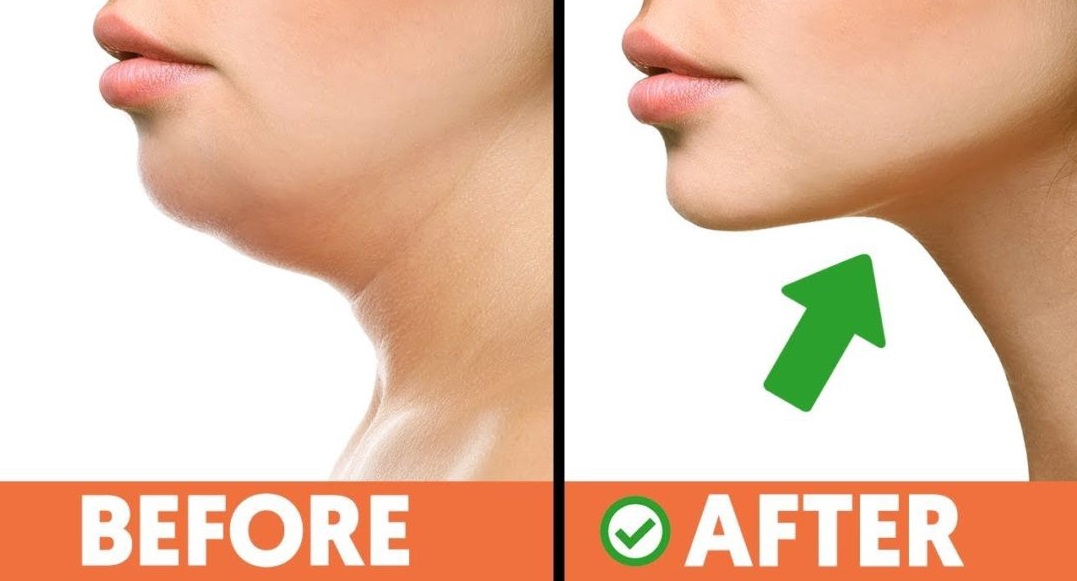 7 Easy Exercises to Get Rid Of Double Chin Fat and Neck Fat Fast - Saayla