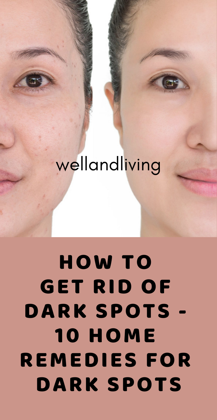 How to Get Rid Of Dark Spots - 10 Home Remedies for Dark Spots - Saayla